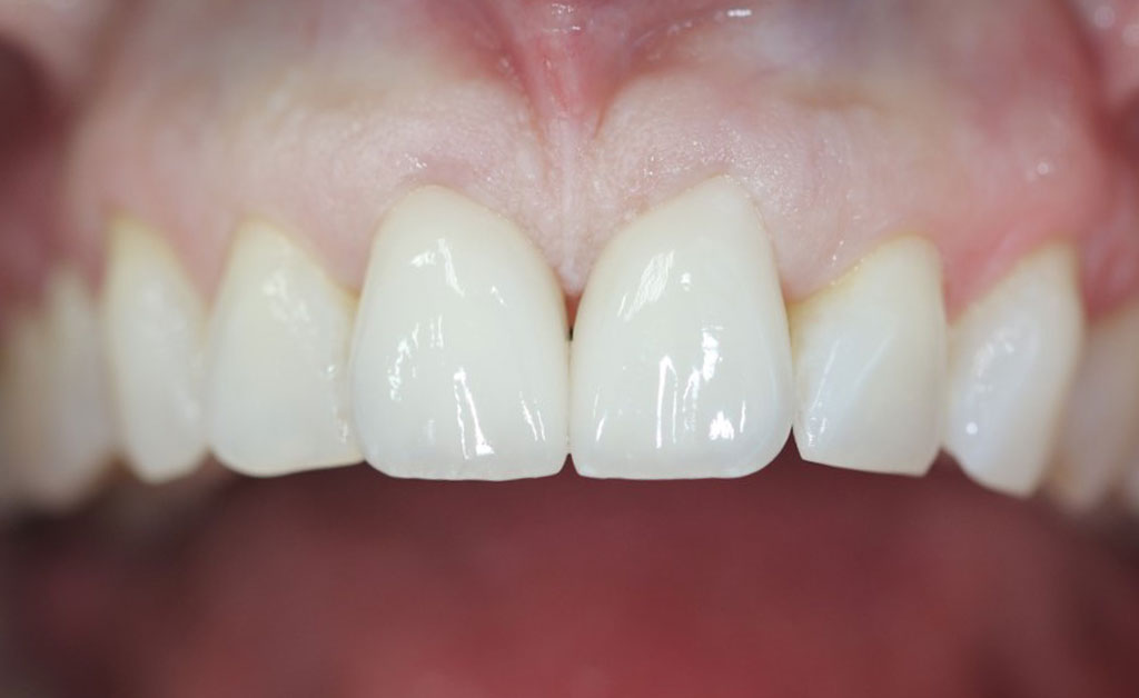 Cases EN - Alpha Smiles