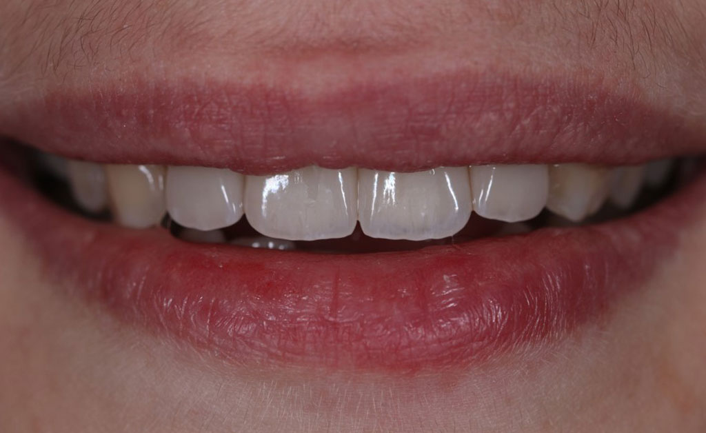 Cases EN - Alpha Smiles